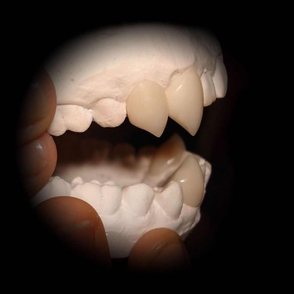 Teeth By Dnash | Fine purveyor of Custom Fangs, Tusks, and Teeth