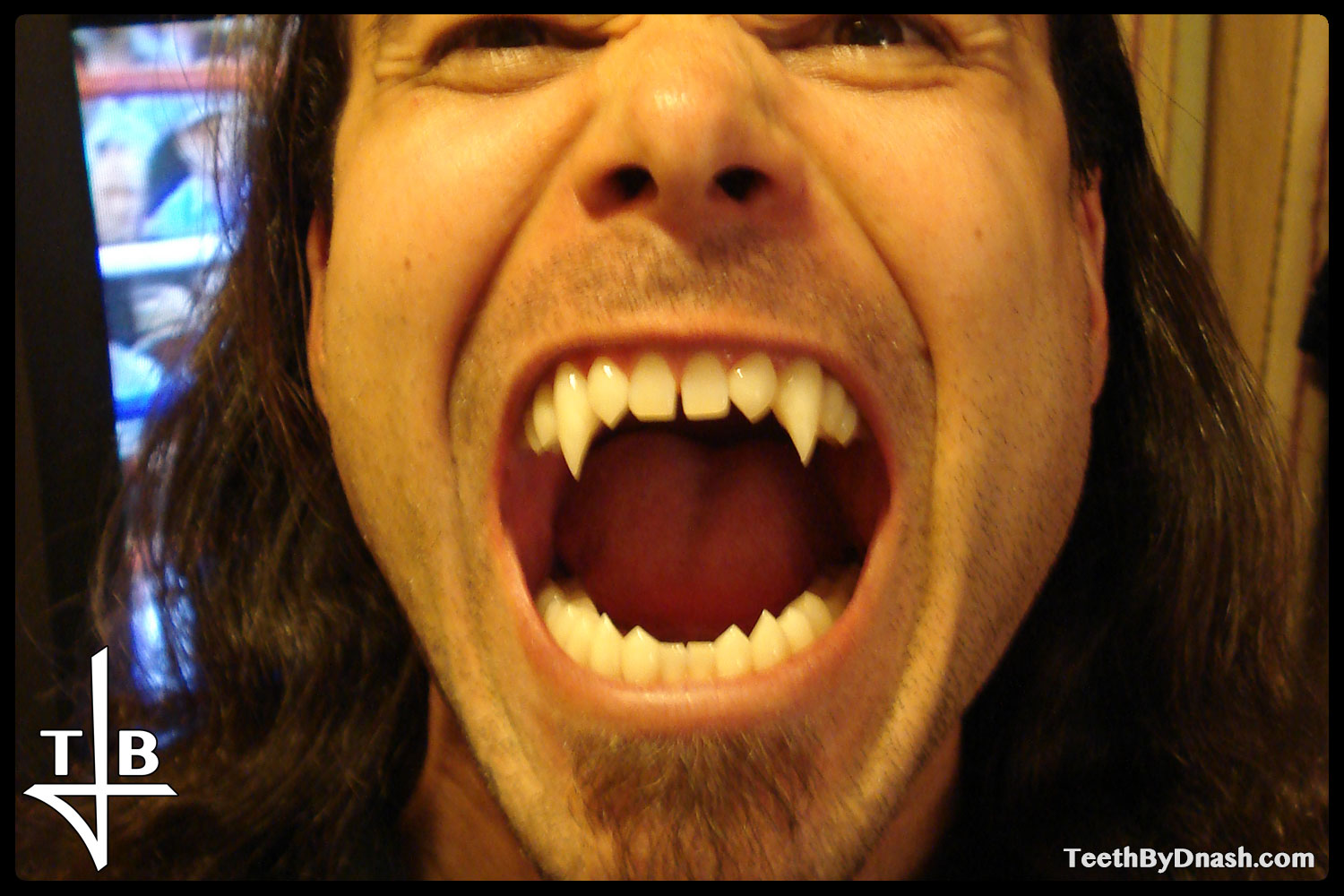 Full Mouth - Teeth By Dnash