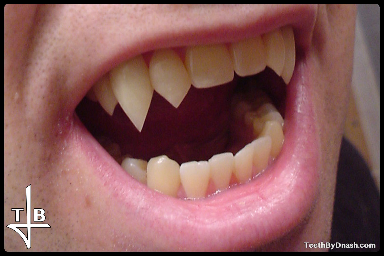 Interview - Teeth By Dnash