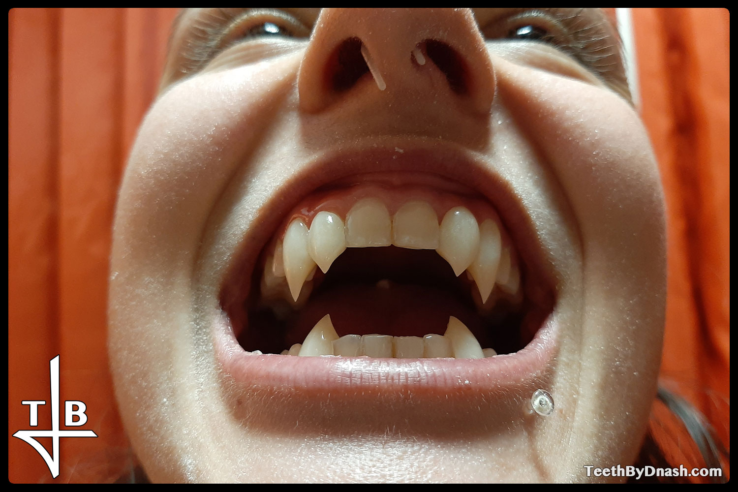 Rogue - Teeth By Dnash