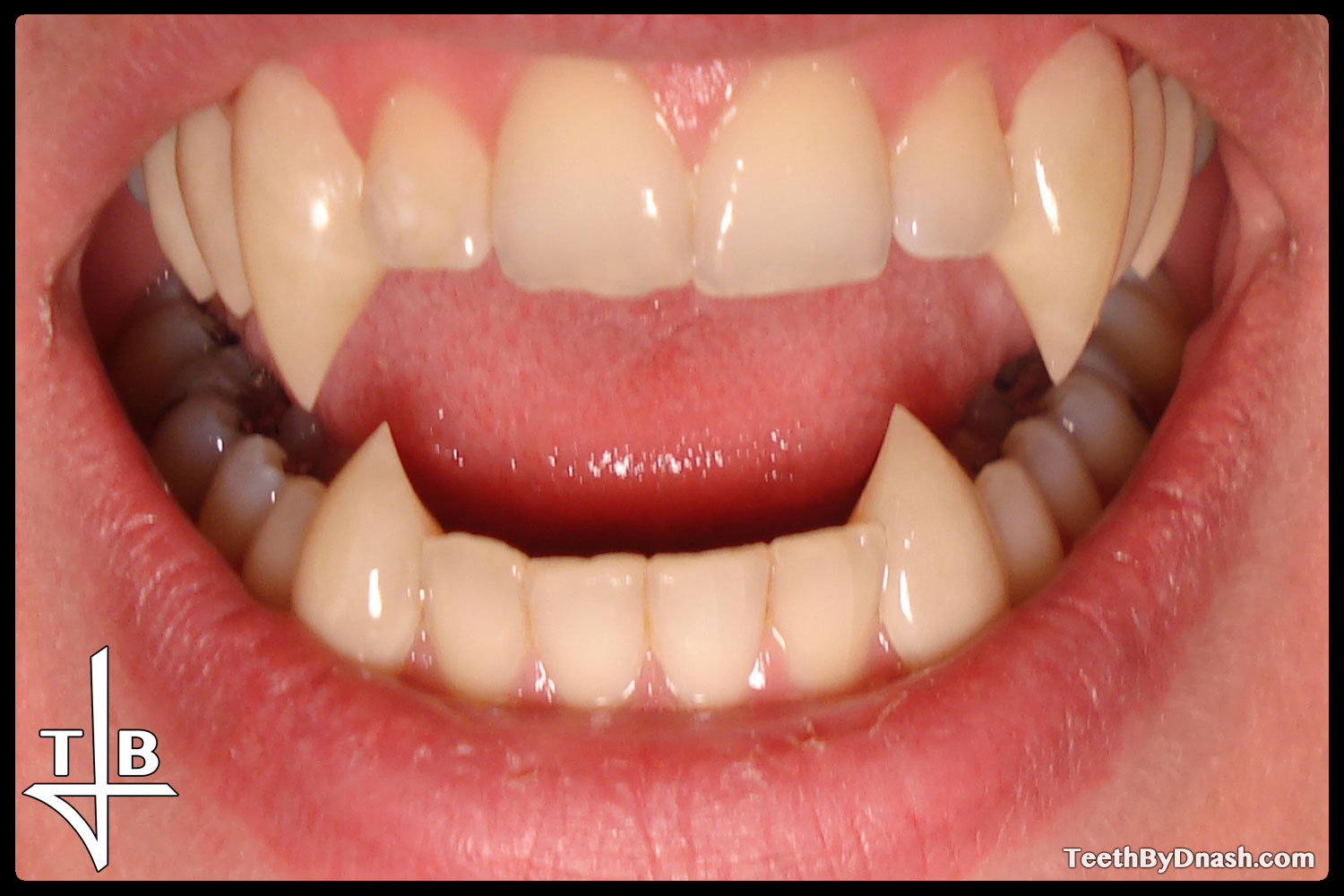 Thirst - Teeth By Dnash