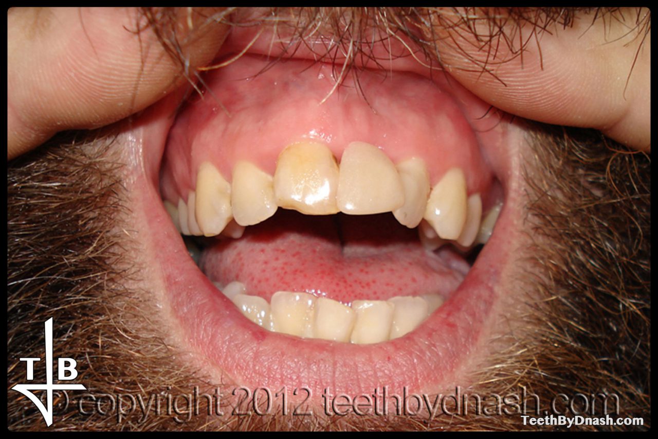 Problem Mouths - Teeth By Dnash