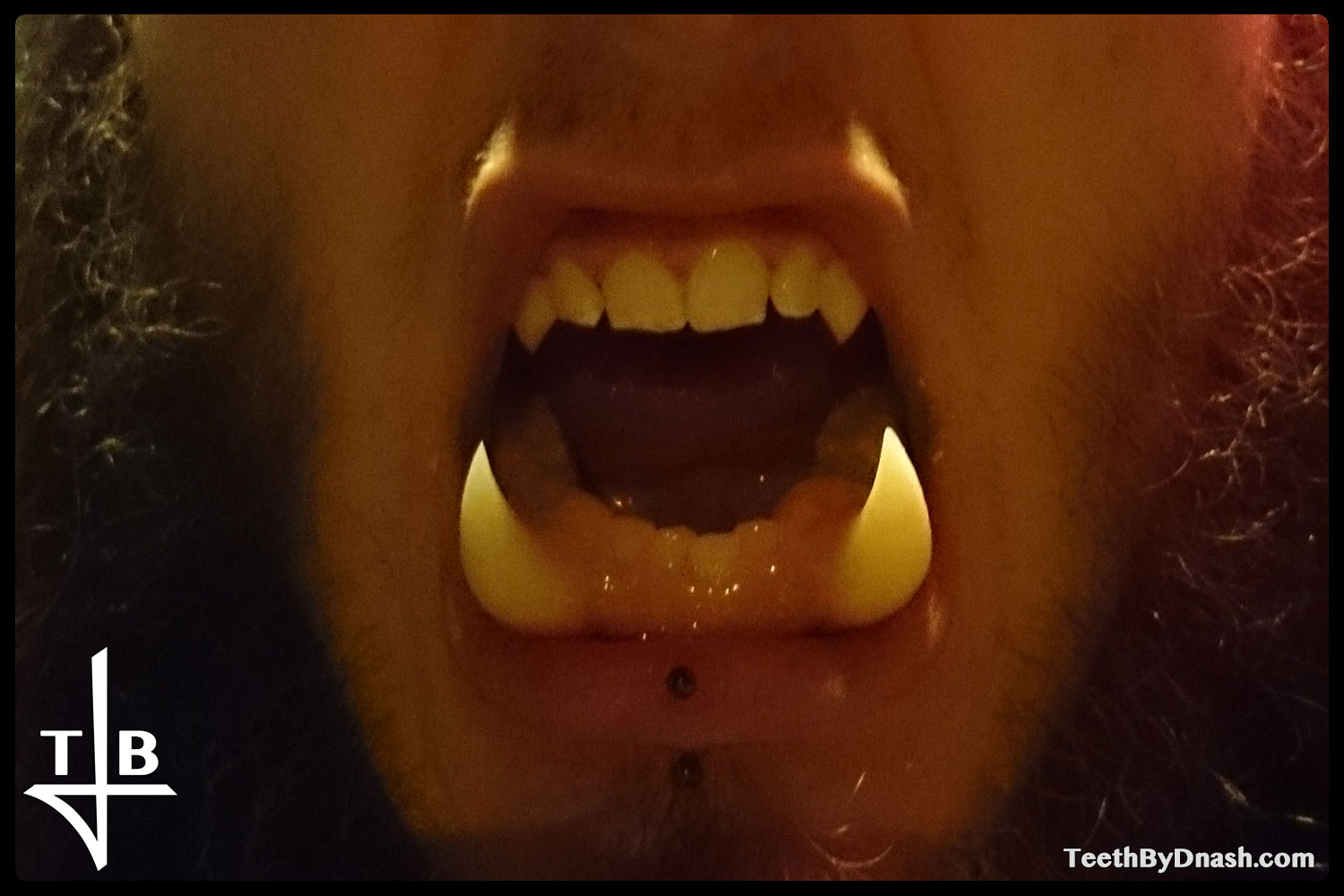 Tusks - Teeth By Dnash