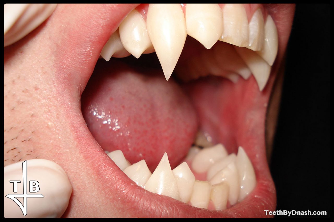 TBD | Teeth By Dnash